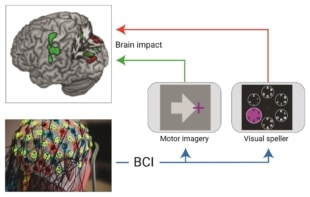 Brain–computer interface could be tailored to treat brain disorders ...