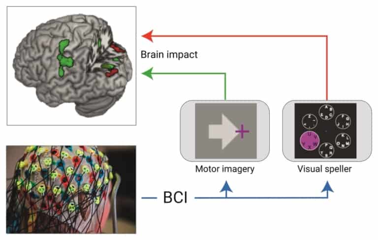 Brain–computer interface could be tailored to treat brain disorders ...