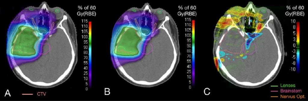 Radiation response model sheds light on proton RBE – Physics World