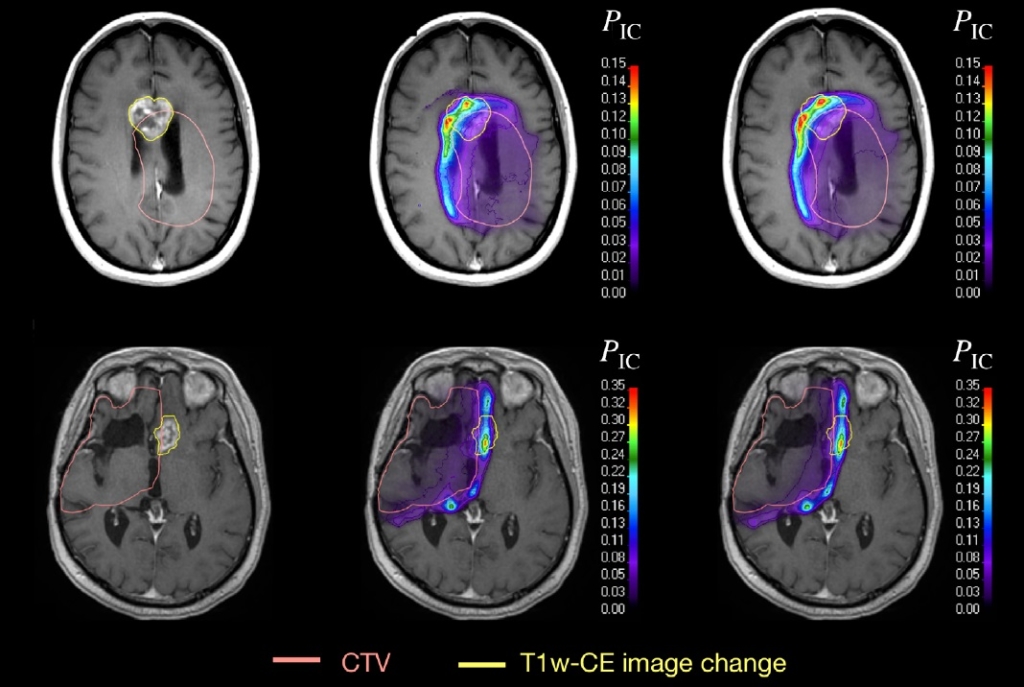 Radiation response model sheds light on proton RBE – Physics World
