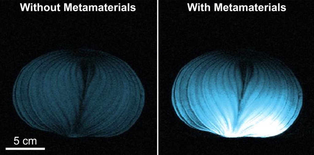 Nonlinear metamaterials improve MR imaging – Physics World