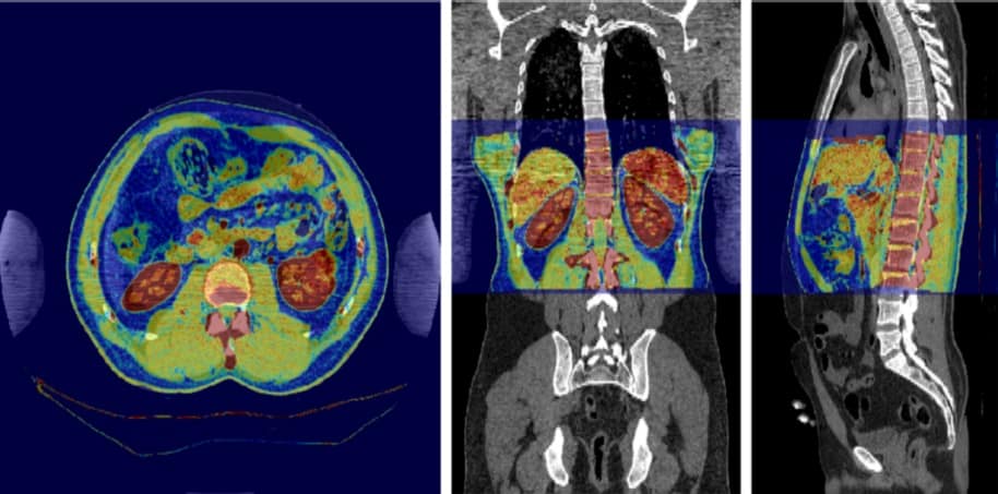 Machine learning for tomographic imaging – Physics World