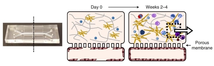 Bone marrow-on-a-chip models damage and disease – Physics World