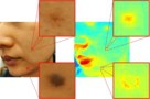 Smartphone camera enables hyperspectral imaging for skin analysis ...