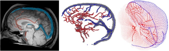Computational model determines dose to blood during radiotherapy ...