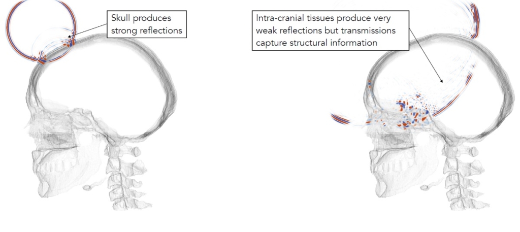 Seismic imaging technology sees deep inside the brain – Physics World