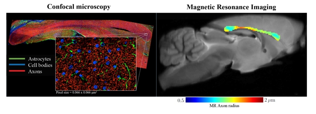 Peeking inside our brains: can MRI quantify axonal features? – Physics ...