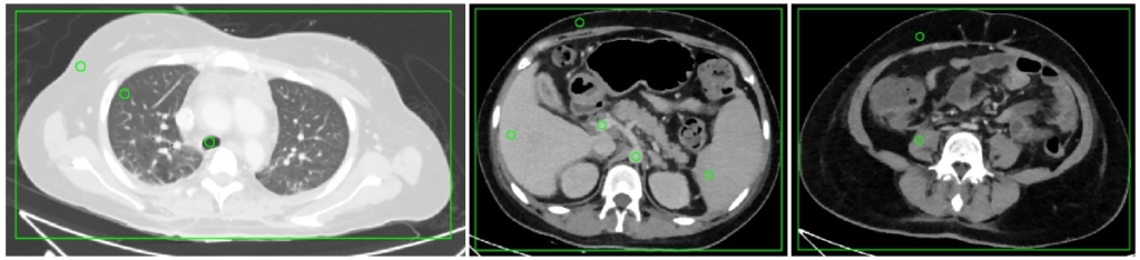 Dual-layer spectral CT proves feasible for routine practice – Physics World