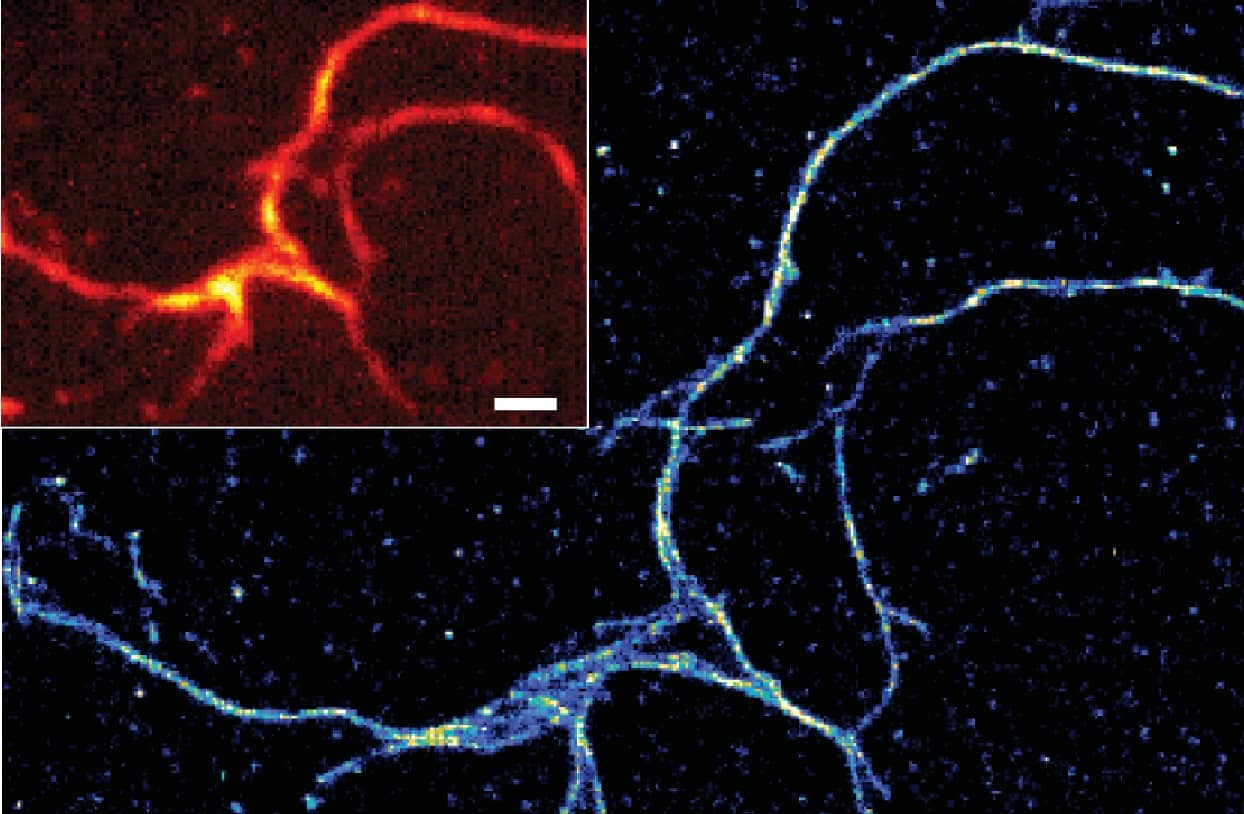 Super-resolution microscopy reveals nanoscale details of amyloid ...