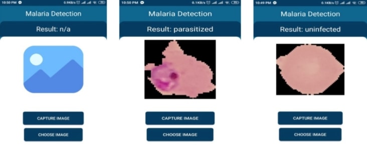 App for low-cost smartphones can diagnose malaria – Physics World