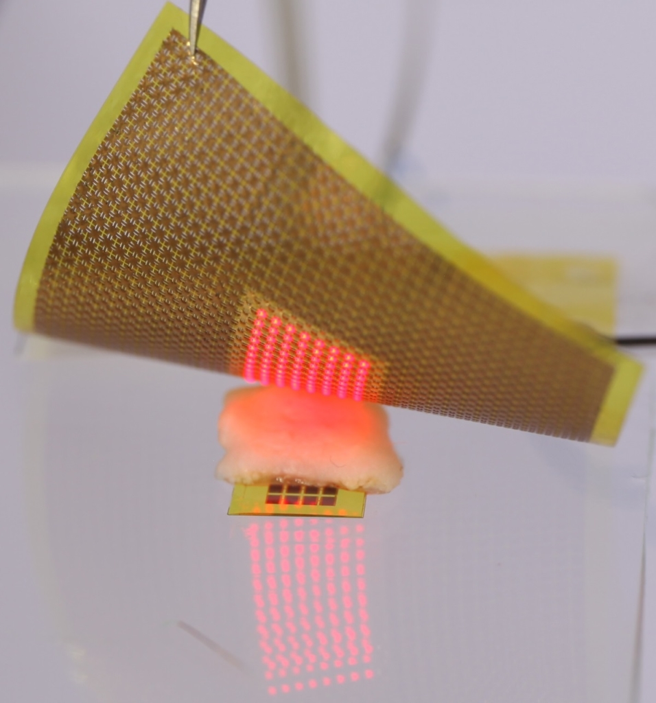 External skin patch transfers power to medical implants – Physics World