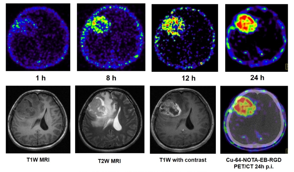 SNMMI Annual Meeting highlights nuclear medicine innovation – Physics World