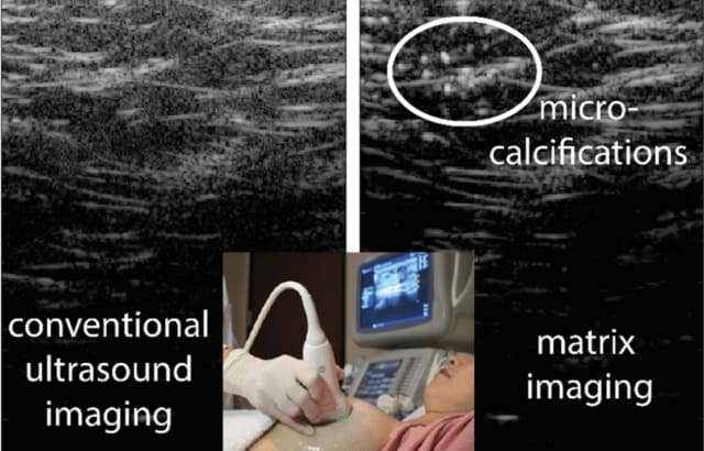 Rojin Jafari, Author at Physics World – Page 2 of 3
