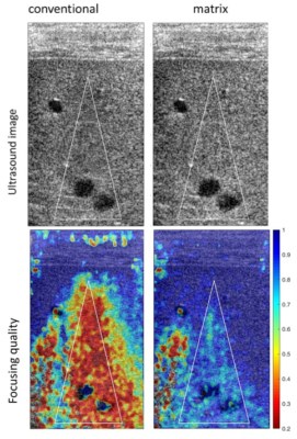Matrix approach removes distortions in ultrasound images – Physics World