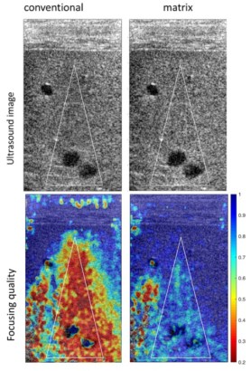 Matrix approach removes distortions in ultrasound images – Physics World