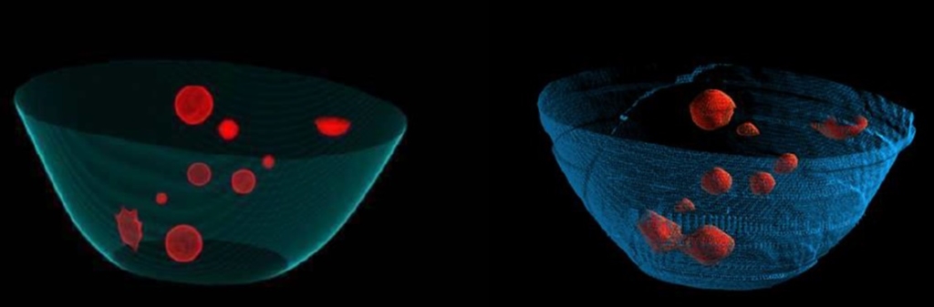 NPL showcases developments in cancer imaging technologies – Physics World