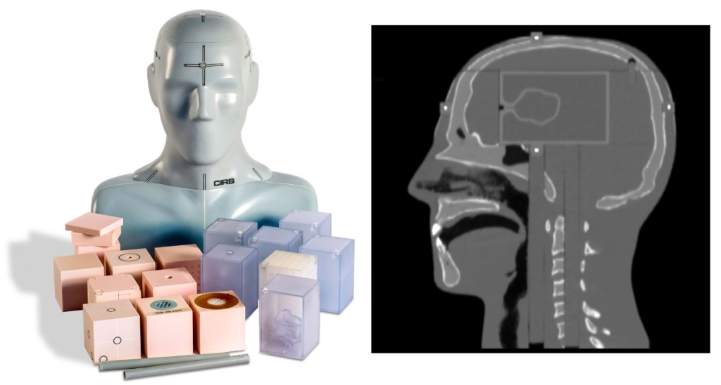 ASTRO Annual Meeting highlights radiation oncology innovation – Physics ...