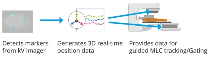 Gating and MLC tracking could increase access to real-time adaptive ...
