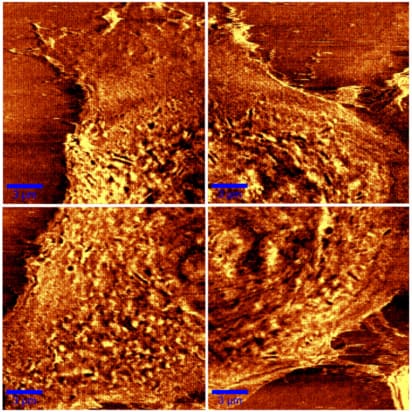 Optical microscopy – how small can it go? – Physics World