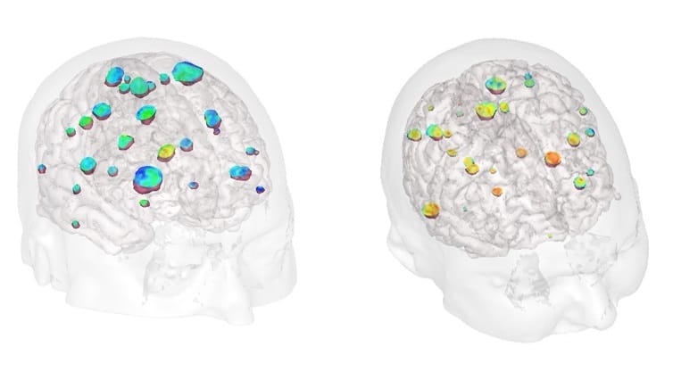 Nanoparticle sensitizers could enhance radiotherapy effectiveness ...