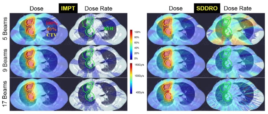 Dose-rate optimization increases healthy tissue sparing during FLASH ...
