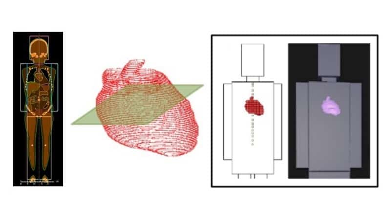 Updated heart model takes radiotherapy outcome research to new ...