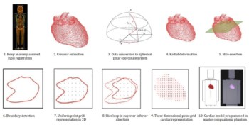 Updated heart model takes radiotherapy outcome research to new ...