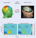 Quantum physics gives brain-sensing MEG scanners a boost – Physics World
