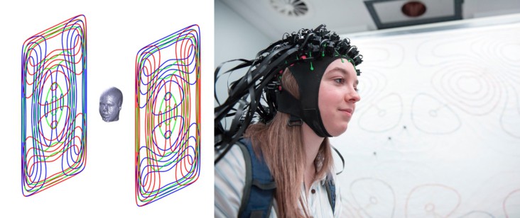 Quantum physics gives brain-sensing MEG scanners a boost – Physics World