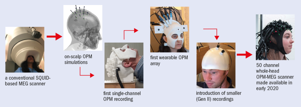 Quantum physics gives brain-sensing MEG scanners a boost – Physics World