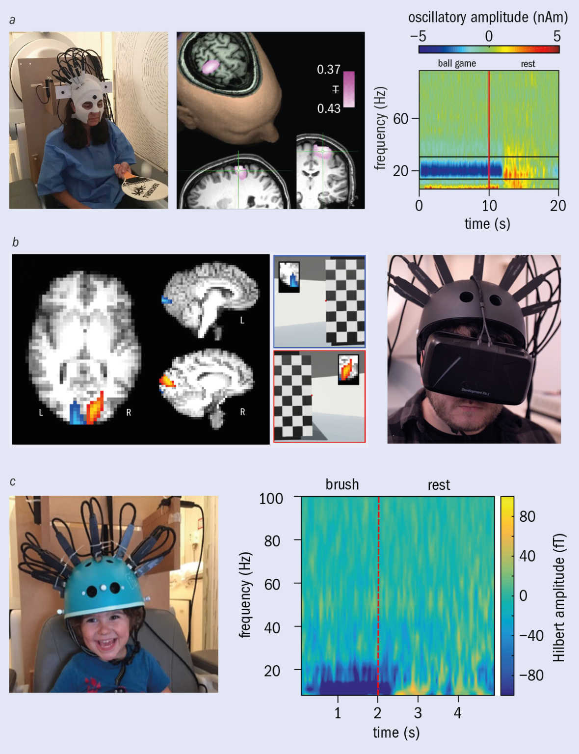 Quantum physics gives brain-sensing MEG scanners a boost – Physics World