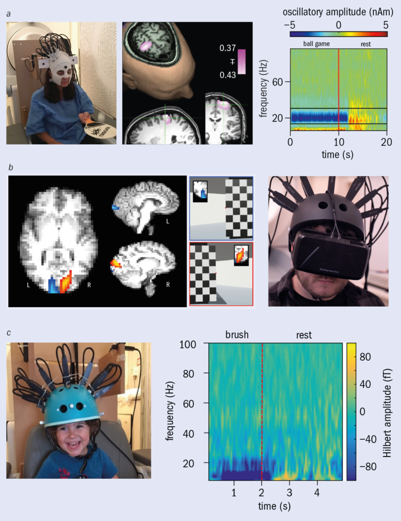 Quantum physics gives brain-sensing MEG scanners a boost – Physics World