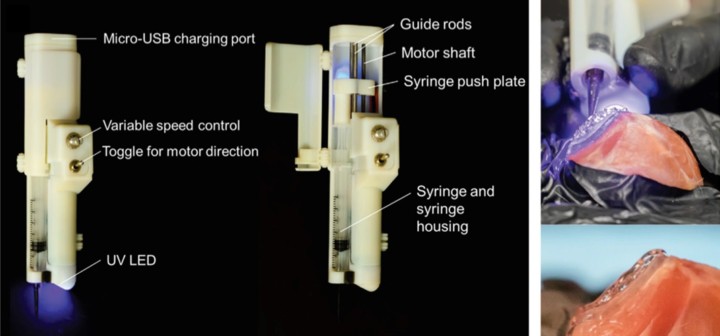 Direct in-muscle bioprinting can treat massive trauma injuries ...