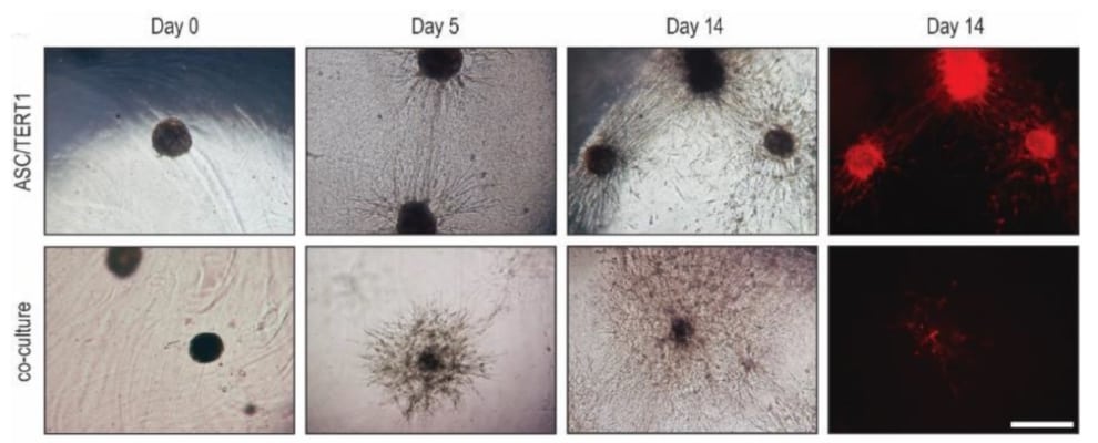 Mass produced spheroids line up for tissue repair – Physics World