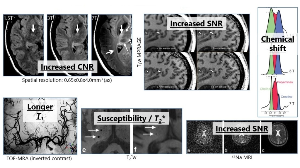 Ultralow-field MRI scanner could improve global access to neuroimaging ...