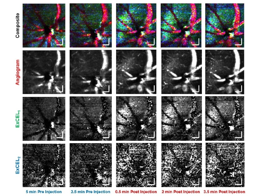 Contrast-enhanced OCT visualizes vascular leakage in the retina ...