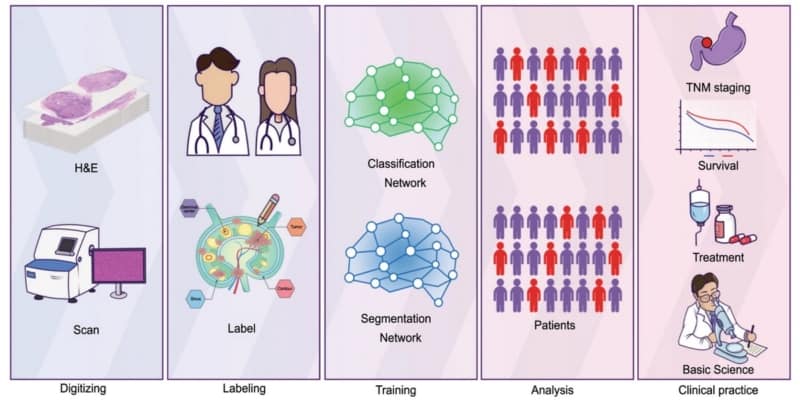 Deep learning helps doctors predict gastric cancer metastasis – Physics ...