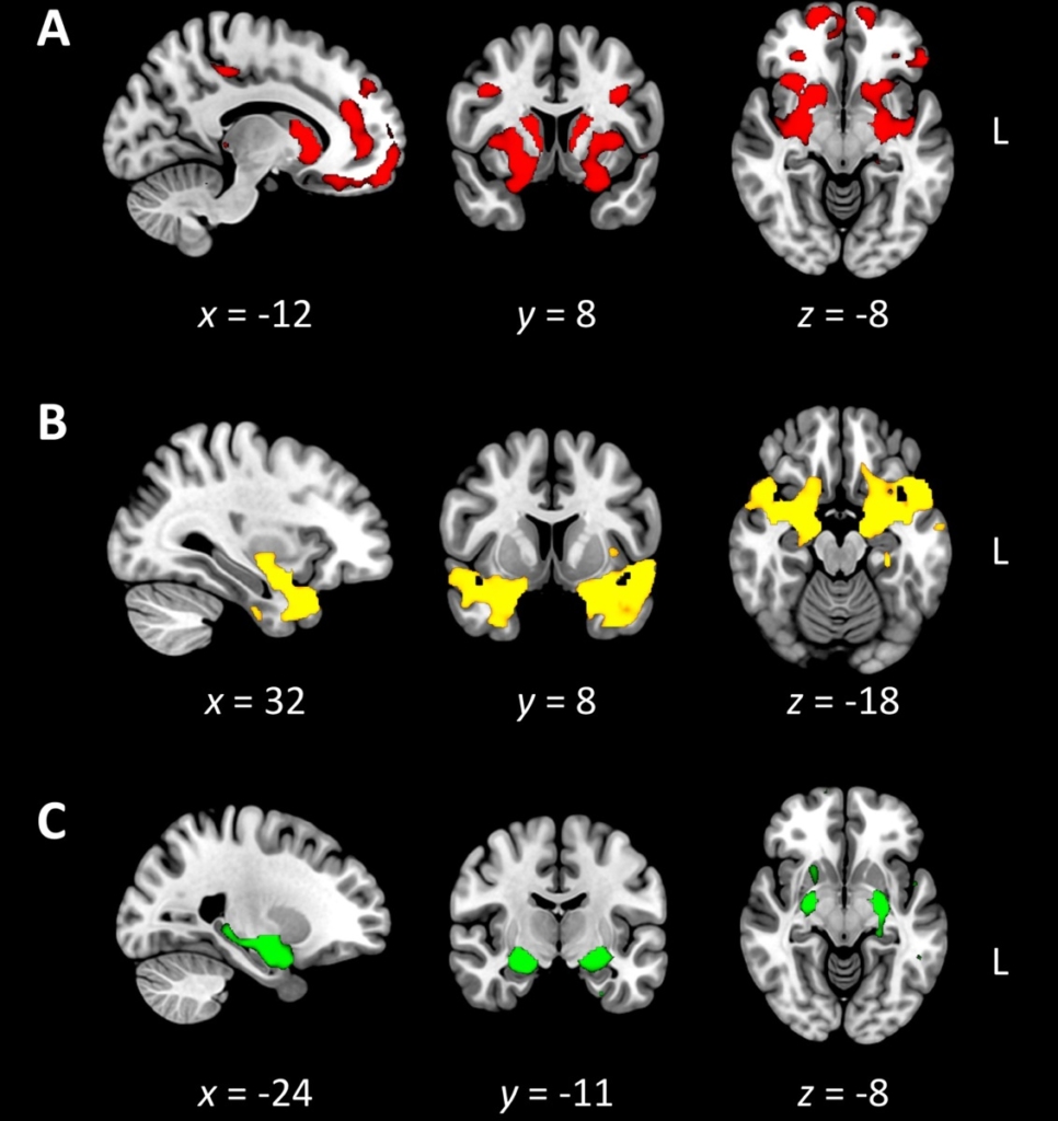 MRI reveals deterioration of brain's reward circuitry in younger-onset ...