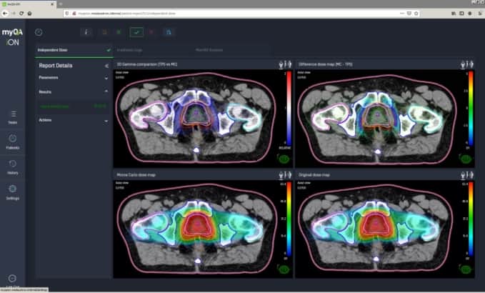 Reimagining Patient Specific Qa In Proton And Ion Therapy Facilities
