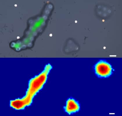 Ultrasonic probe promises stiffness-based disease diagnostics – Physics ...