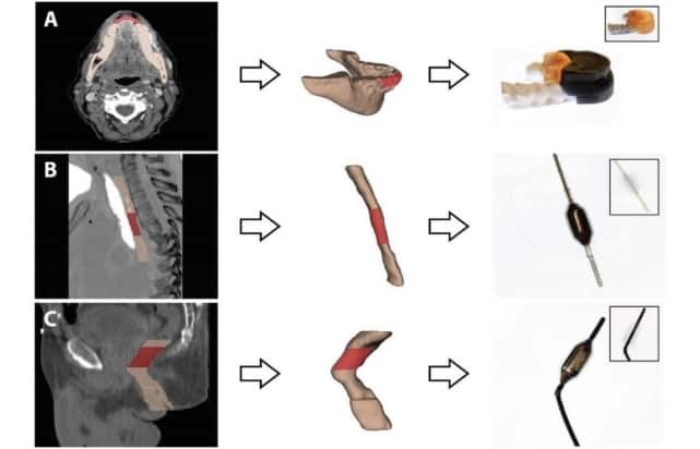 Radiotherapy Archives – Page 3 of 23 – Physics World