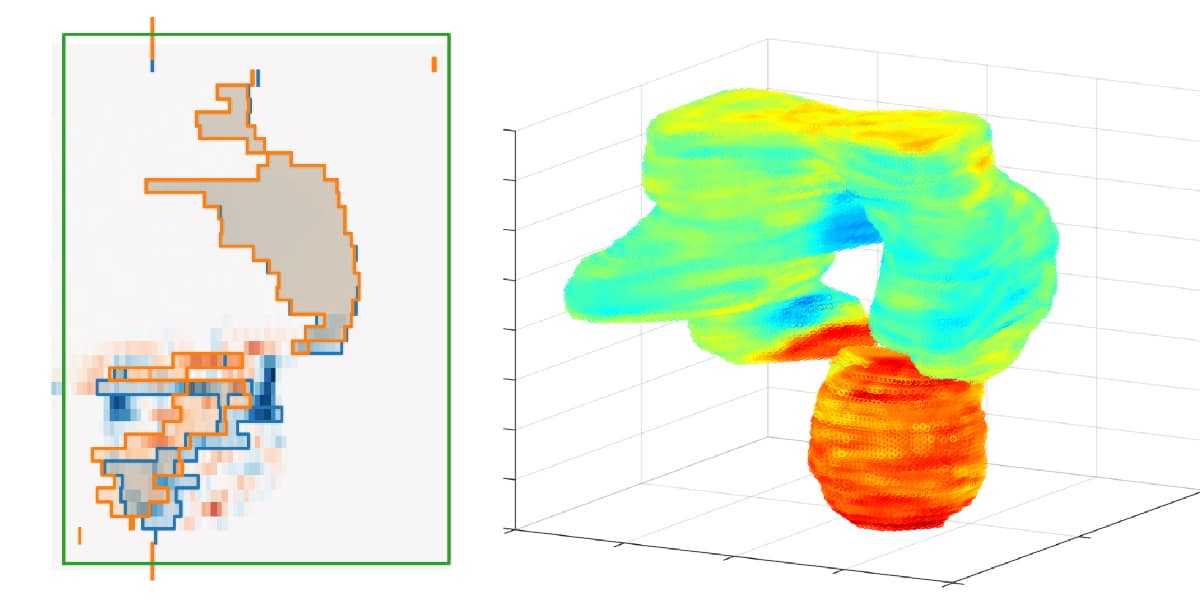 Best in physics: dose-optimized MLC tracking and radio-immunotherapy ...