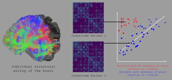 Mapping the brain’s neural connections can predict recovery after ...