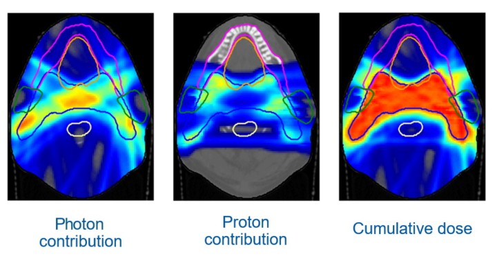 Protons combine with photons to optimize cancer treatments – Physics World