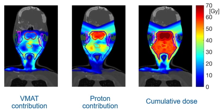 Protons combine with photons to optimize cancer treatments – Physics World