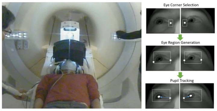 I spy: a virtual reality system in the MRI – Physics World