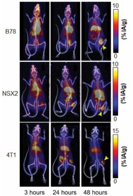 Low-dose radiation plus immunotherapy can eliminate metastatic cancer ...