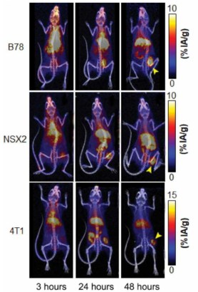 Low-dose radiation plus immunotherapy can eliminate metastatic cancer ...