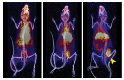 Low-dose radiation plus immunotherapy can eliminate metastatic cancer ...