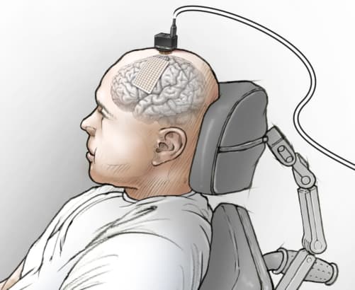 Think before you ‘speak’: brain–computer interface restores speech in ...